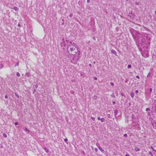 Eosin Y alcoholic solution - Pathotec AG