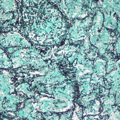 Grocott 100 test - Pathotec AG